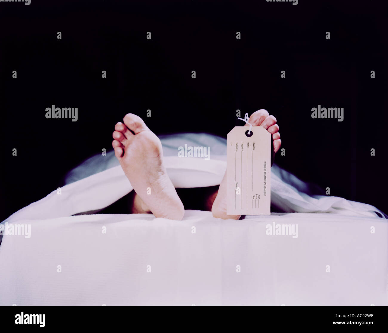 Dead feet hi-res stock photography and images - Alamy