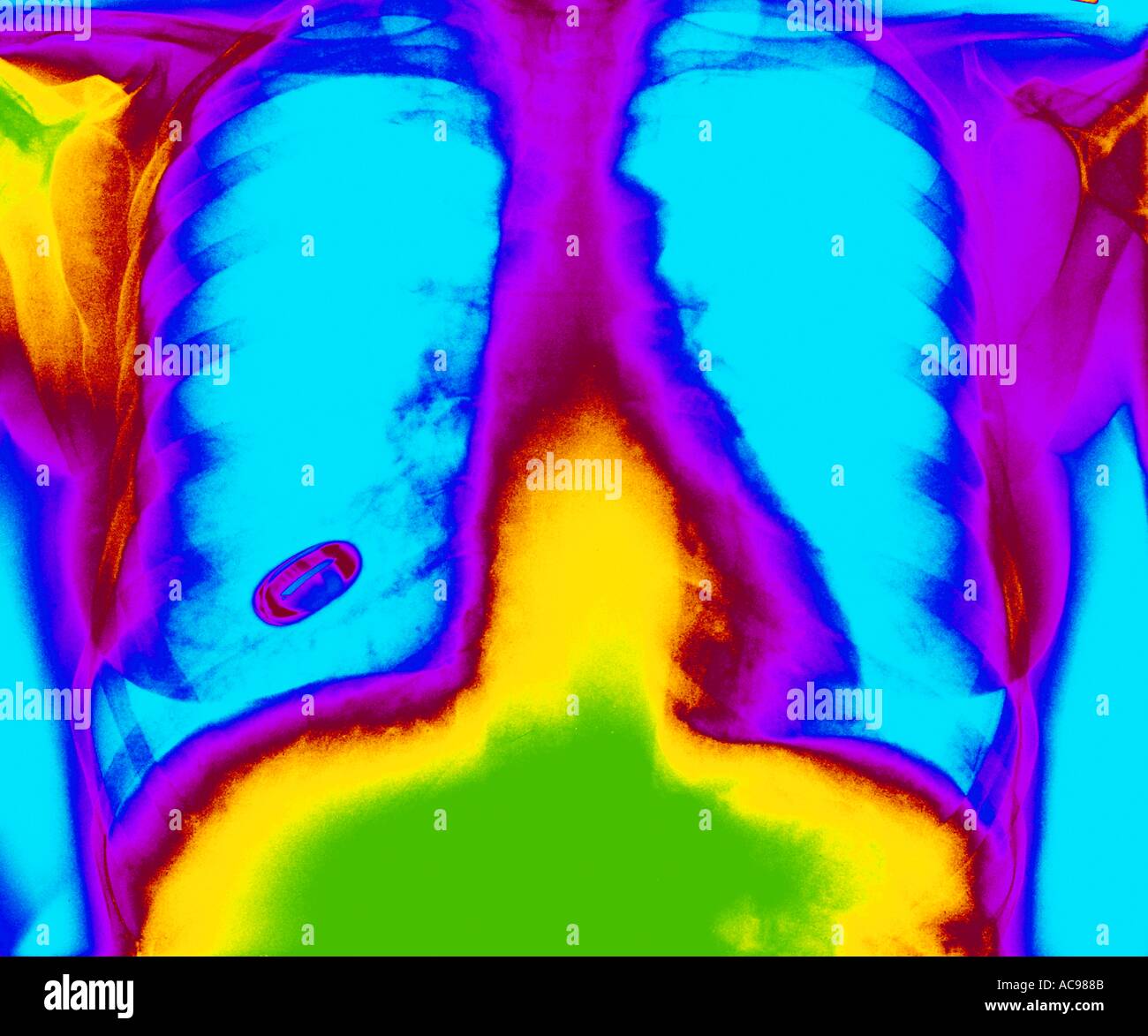 Body heat map hi-res stock photography and images - Alamy
