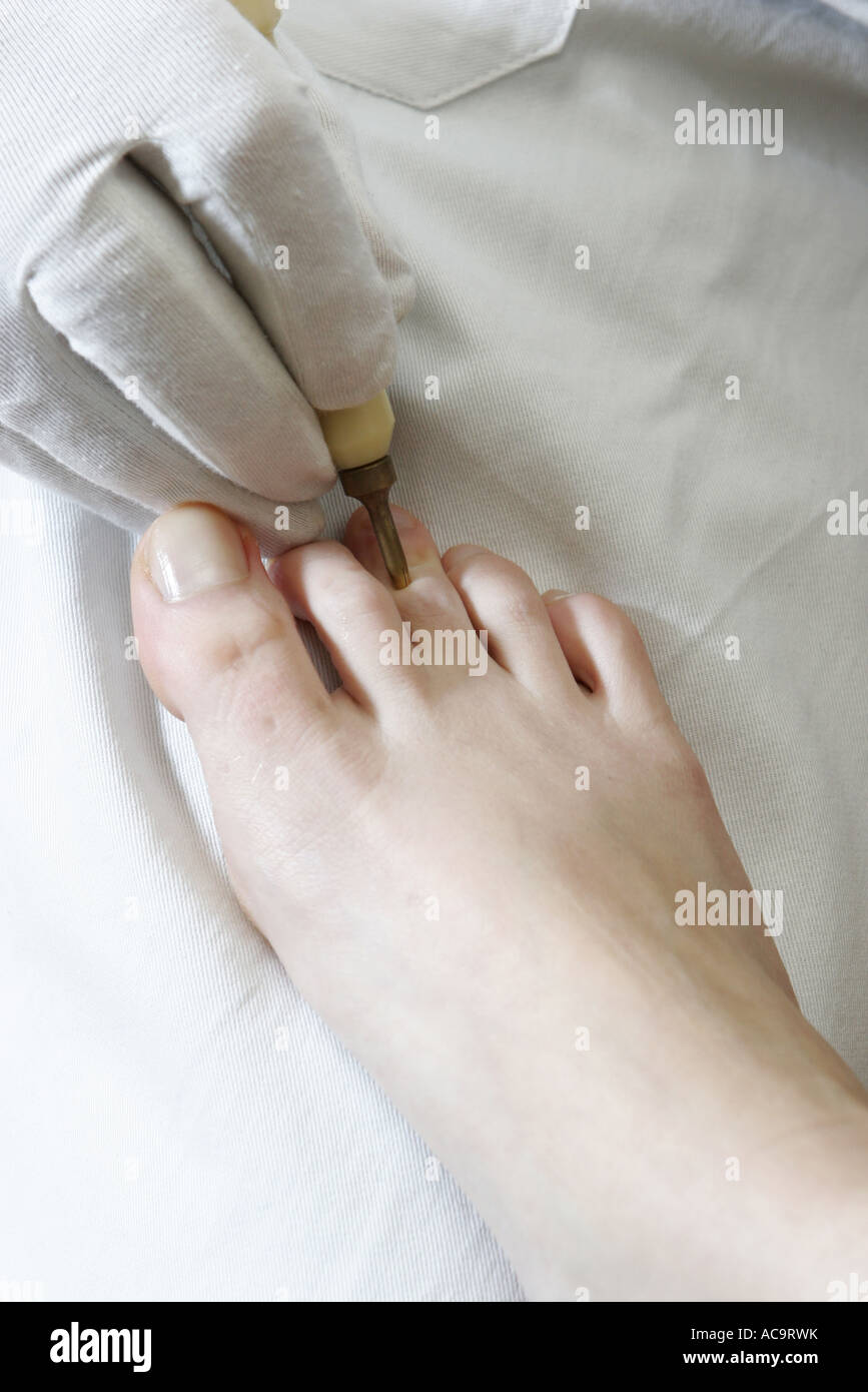 Measuring acupoints impedance by EAV L instrument Stock Photo - Alamy