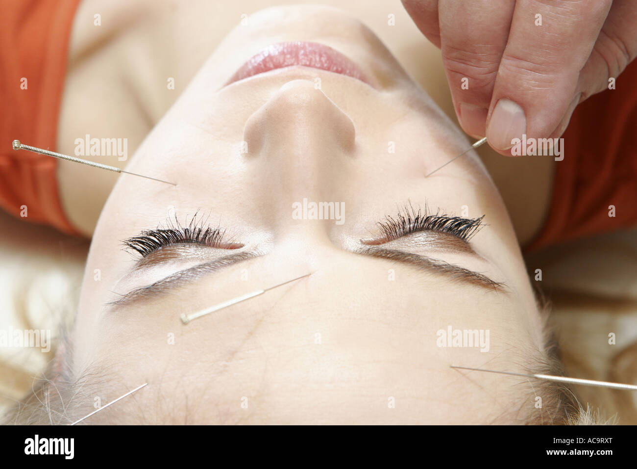 Inserting of acupuncture needle to the face Stock Photo - Alamy