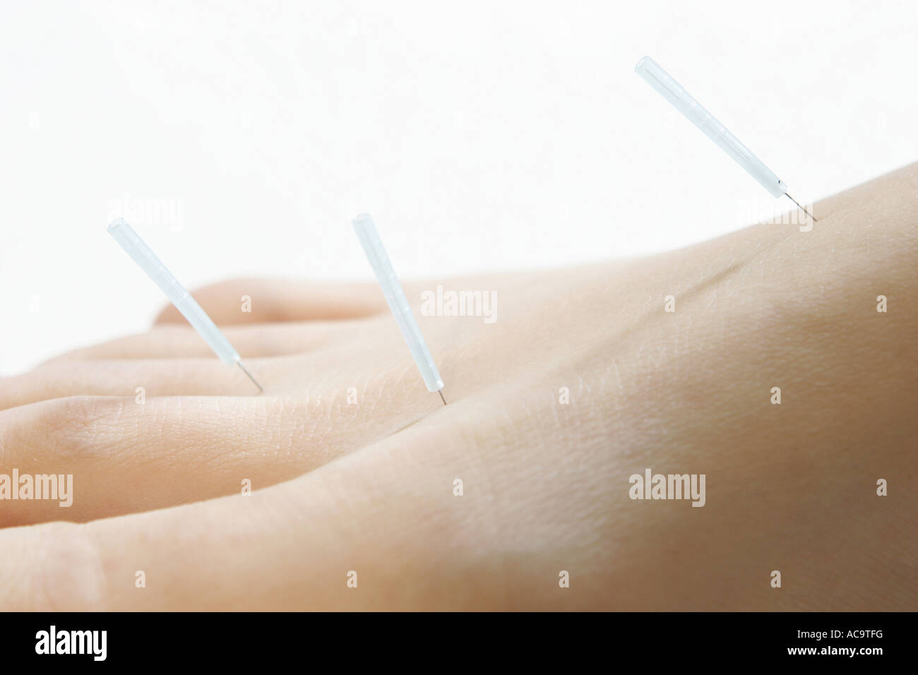 Examination of the feet of young woman hi-res stock photography and ...