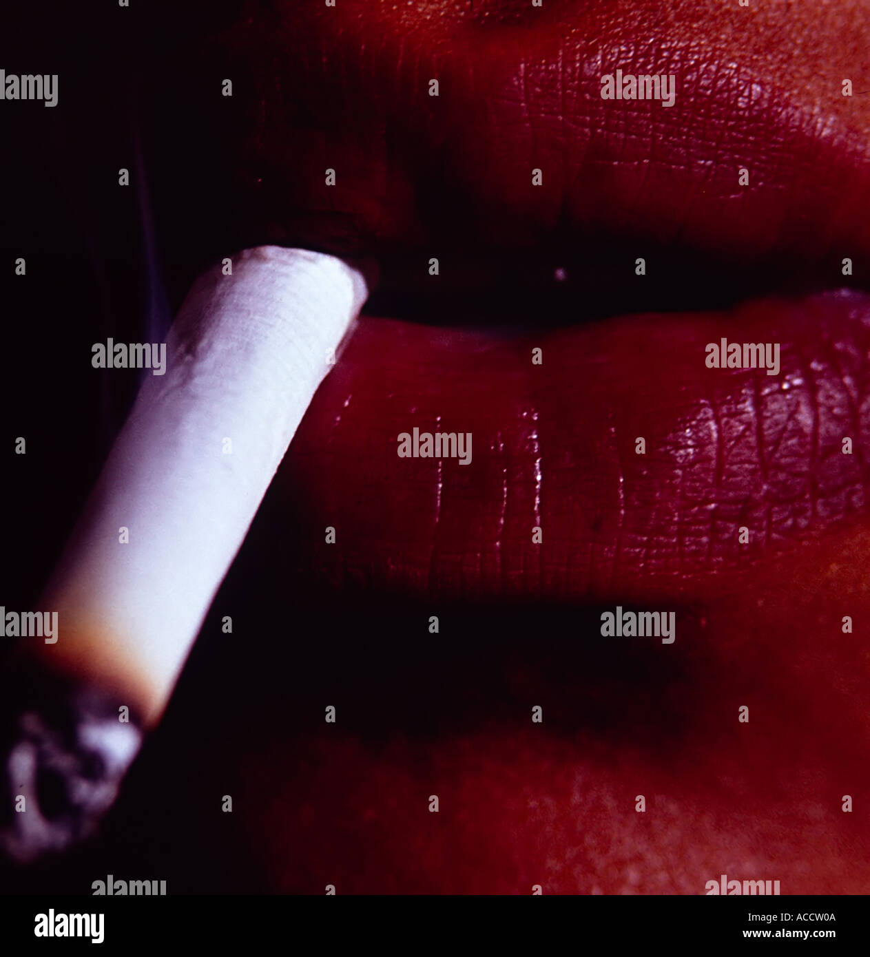 Weed Smoking Lips With Braces