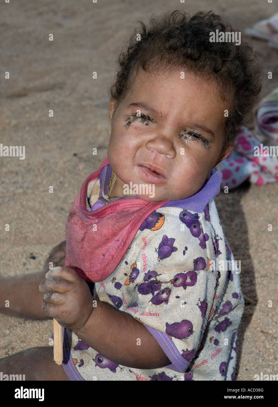 Conjunctivitis is often rife among children in African villages where ...