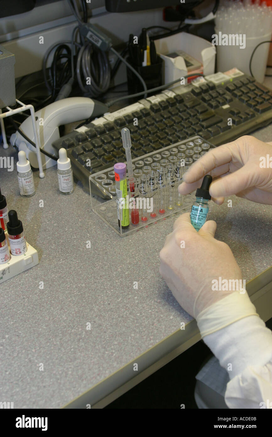 Forensics Testing blood to determine blood type Stock Photo - Alamy