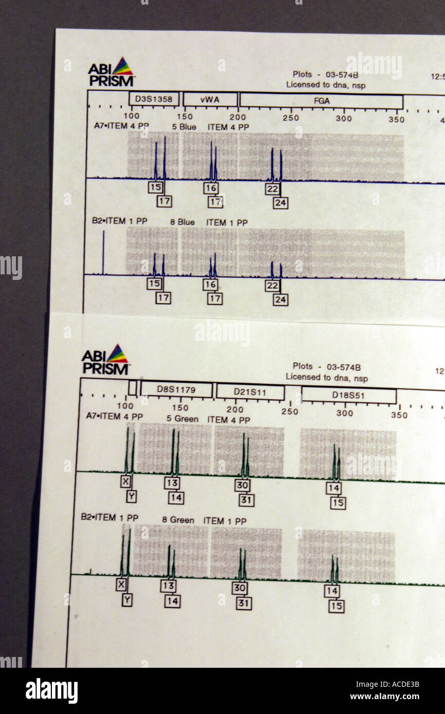 Dna profile hi-res stock photography and images - Alamy