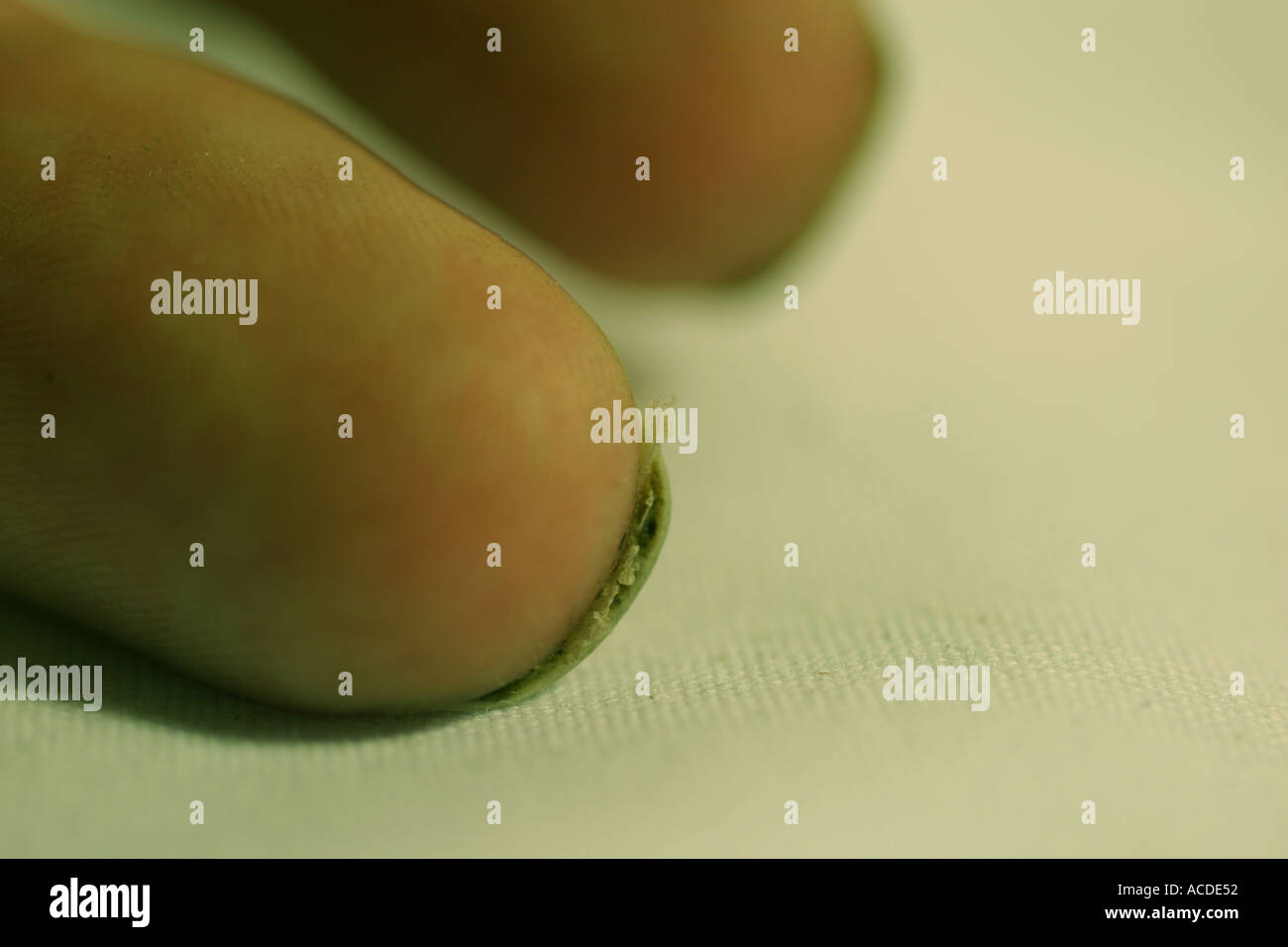 Skin under finger nails When found on victim this often mean that the ...