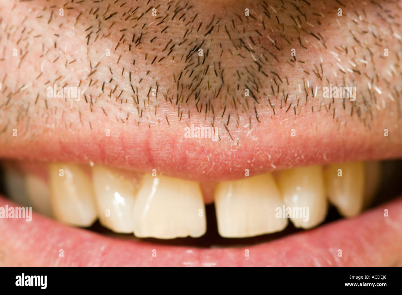 Old mans teeth hi-res stock photography and images - Alamy