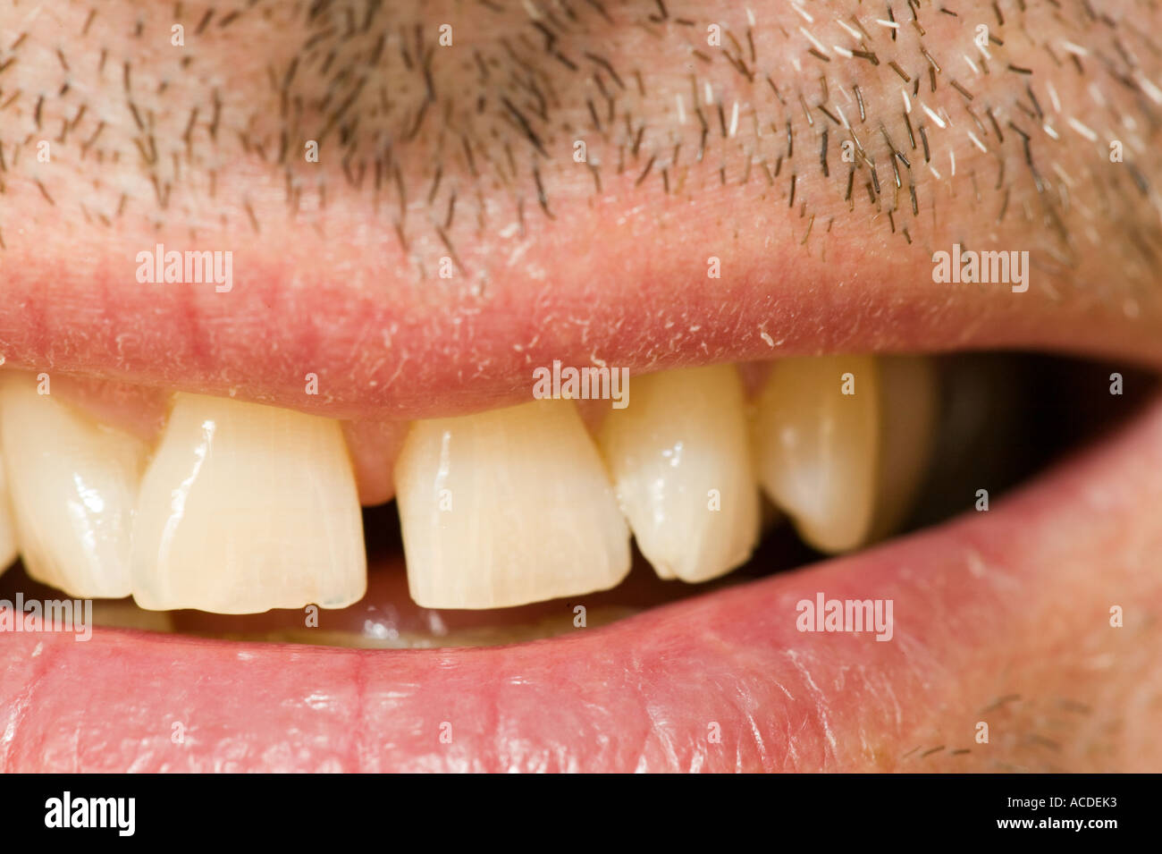 Old mans teeth hi-res stock photography and images - Alamy