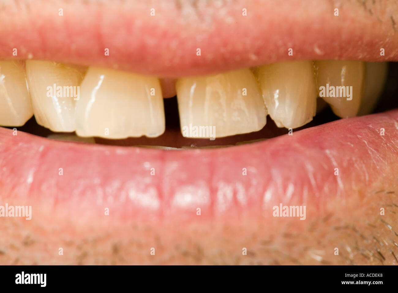 Old mans teeth hi-res stock photography and images - Alamy