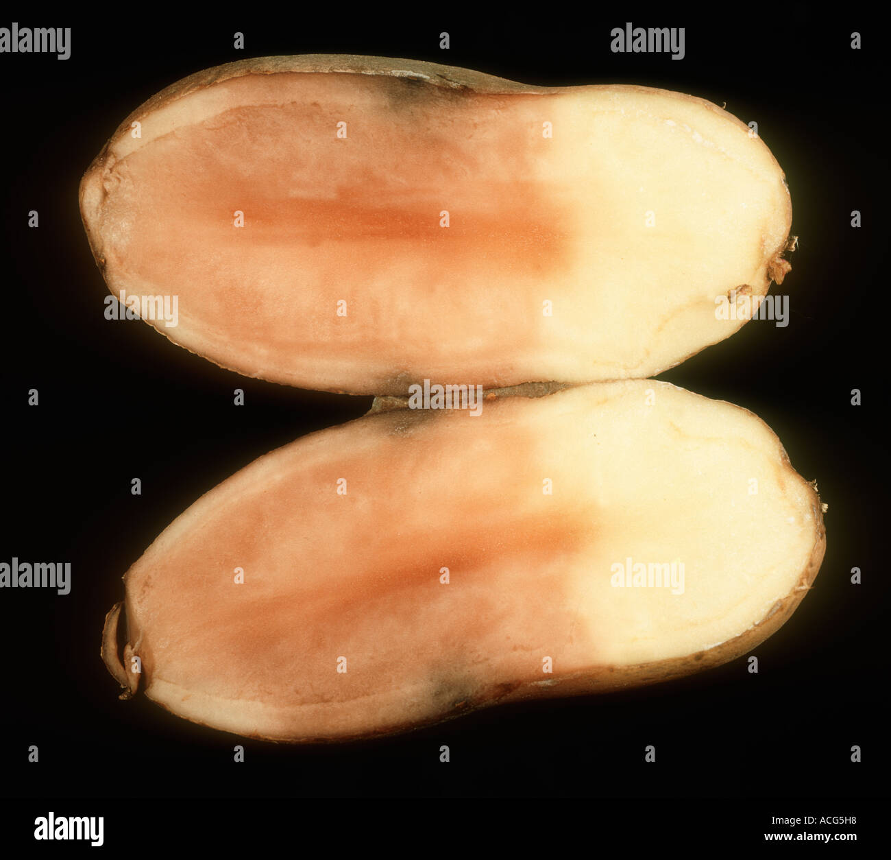 Pink rot Phytophthora erythroseptica infection within potato tuber 5th ...