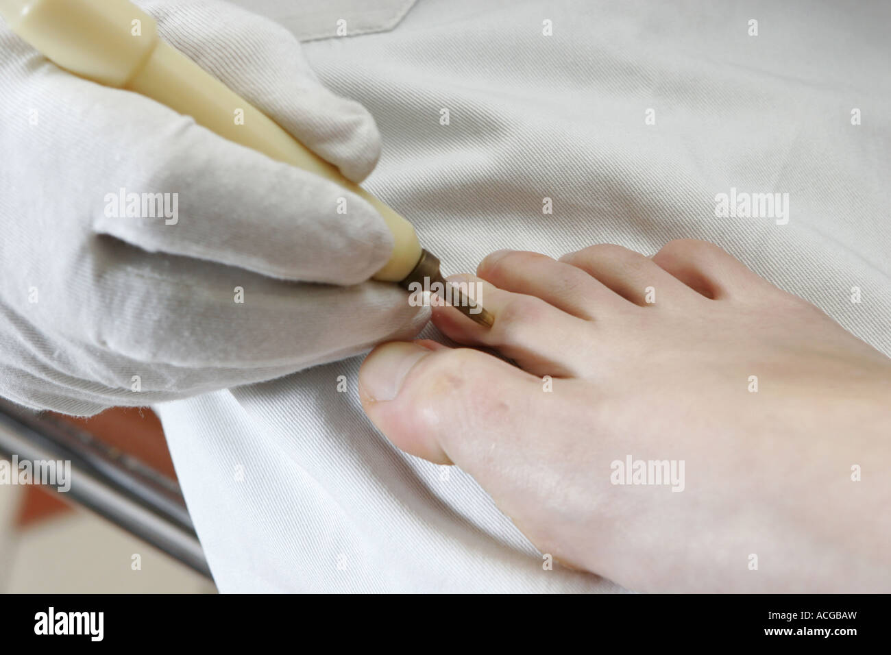 Measuring acupoints impedance by EAV L instrument Stock Photo - Alamy