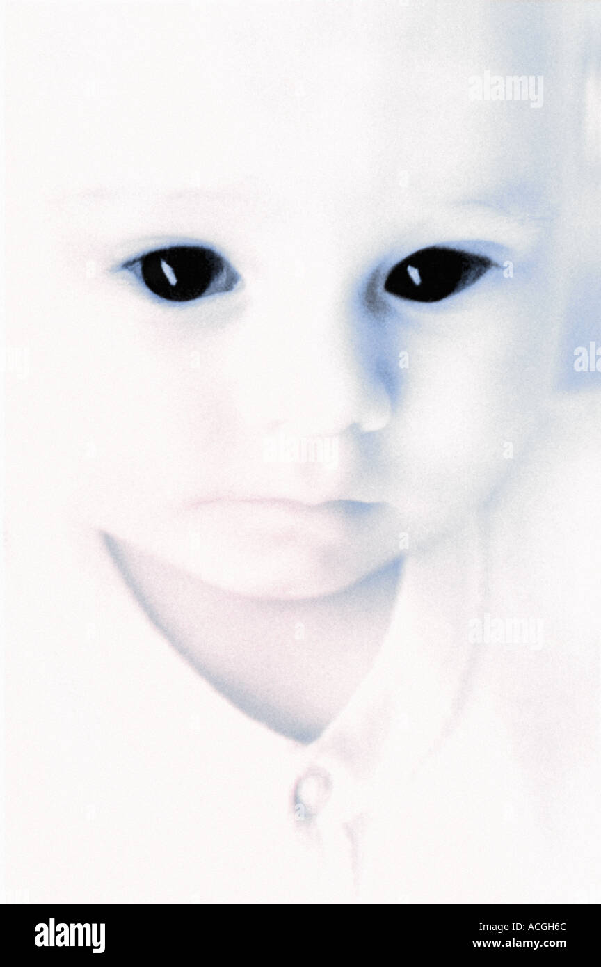 Abnormal baby hi-res stock photography and images - Alamy