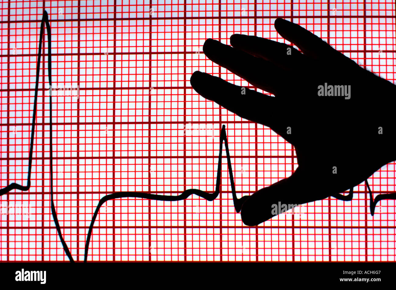 conceptual view of a hand projected on a large monitor of an EKG ...