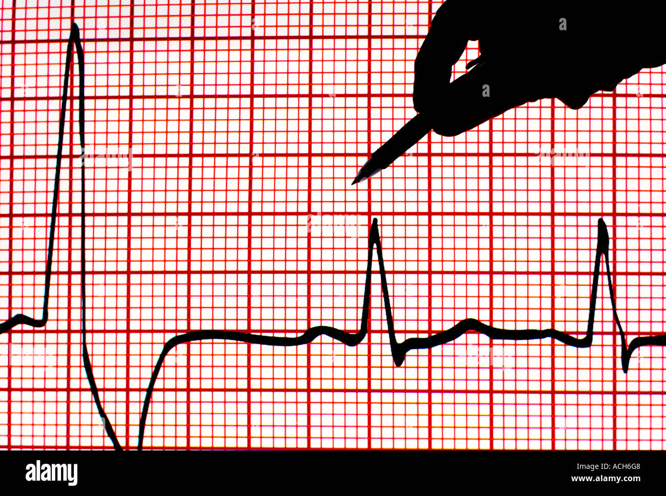 conceptual view of a hand with a pointer projected on a large monitor of an EKG ...
