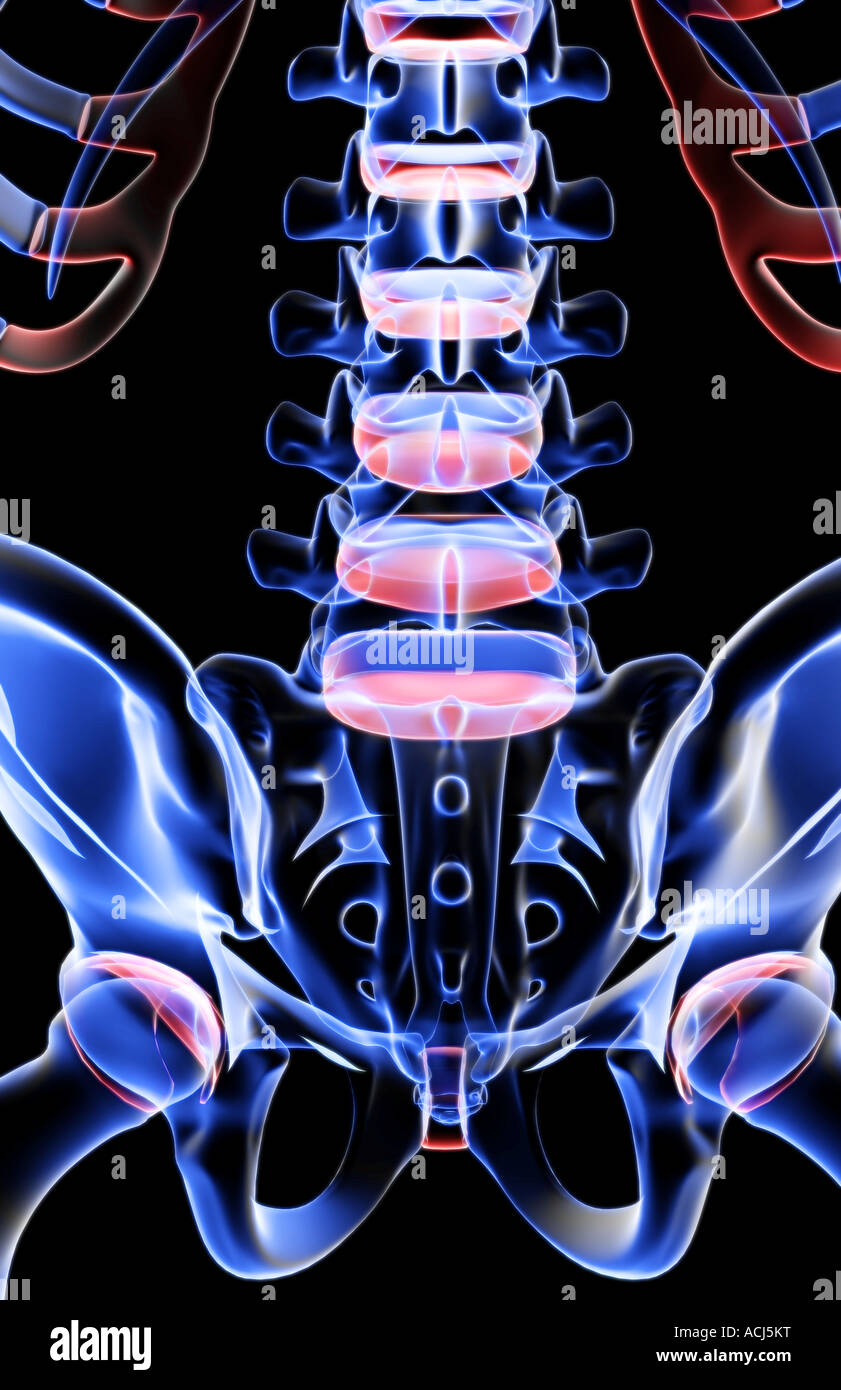 X Ray Lower Back High Resolution Stock Photography and Images - Alamy