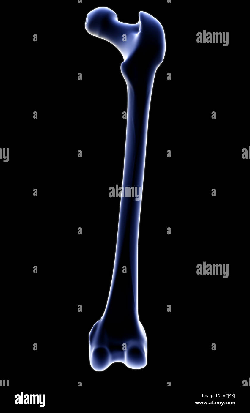 Femur thigh bone ray hi-res stock photography and images - Alamy