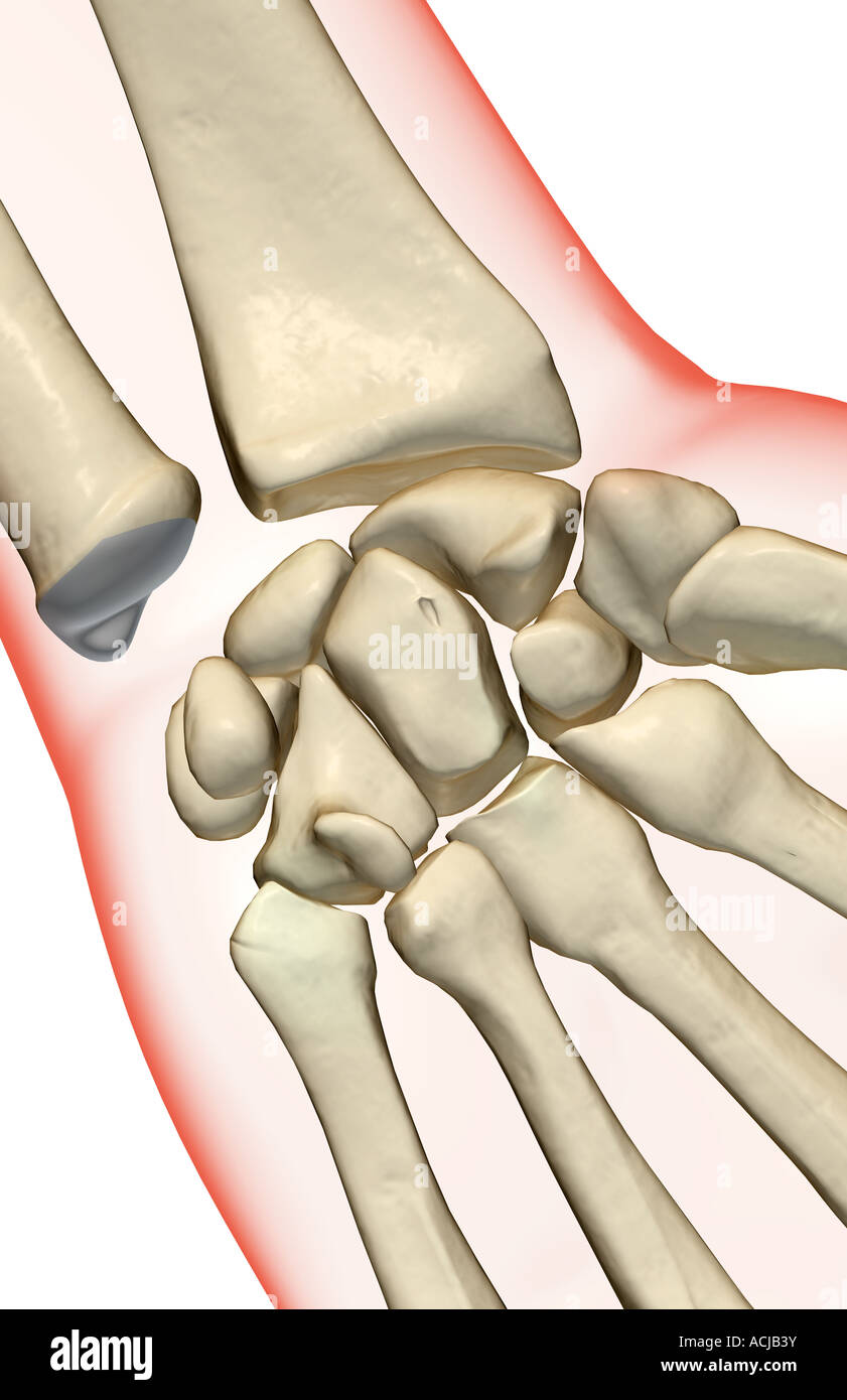Triquetrum Bone High Resolution Stock Photography and Images - Alamy