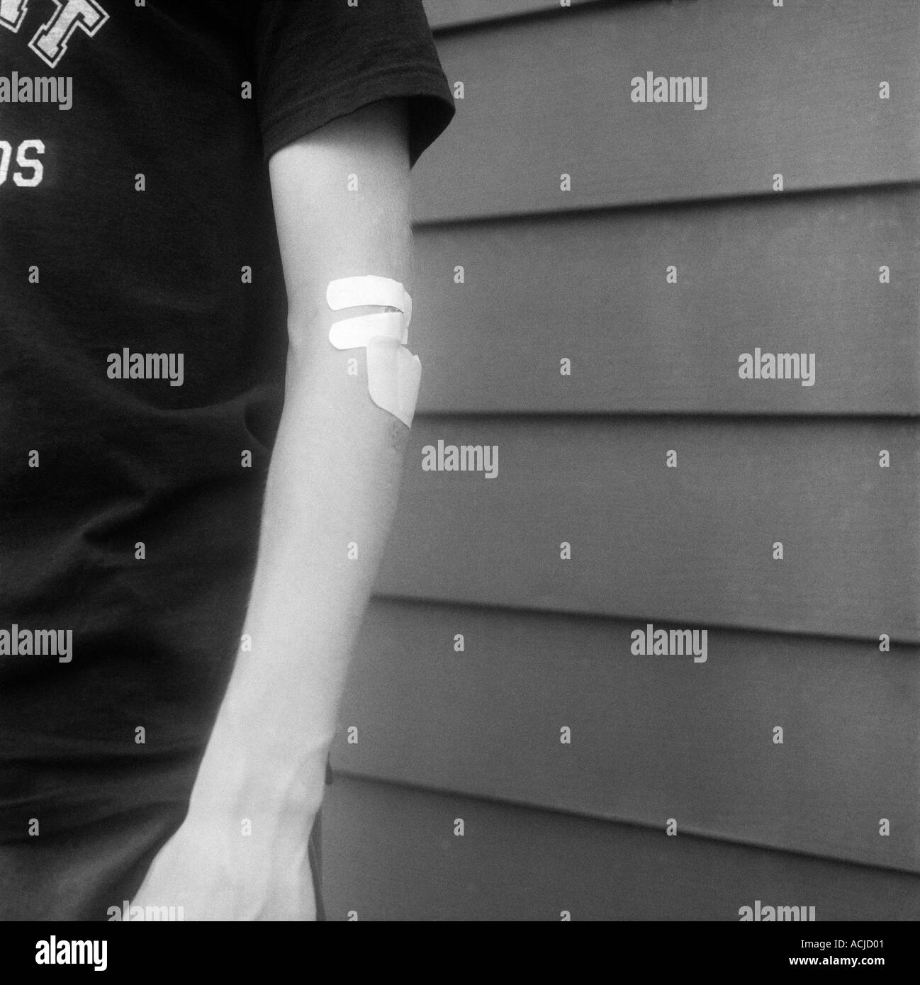 Arm of plaster Black and White Stock Photos & Images - Alamy