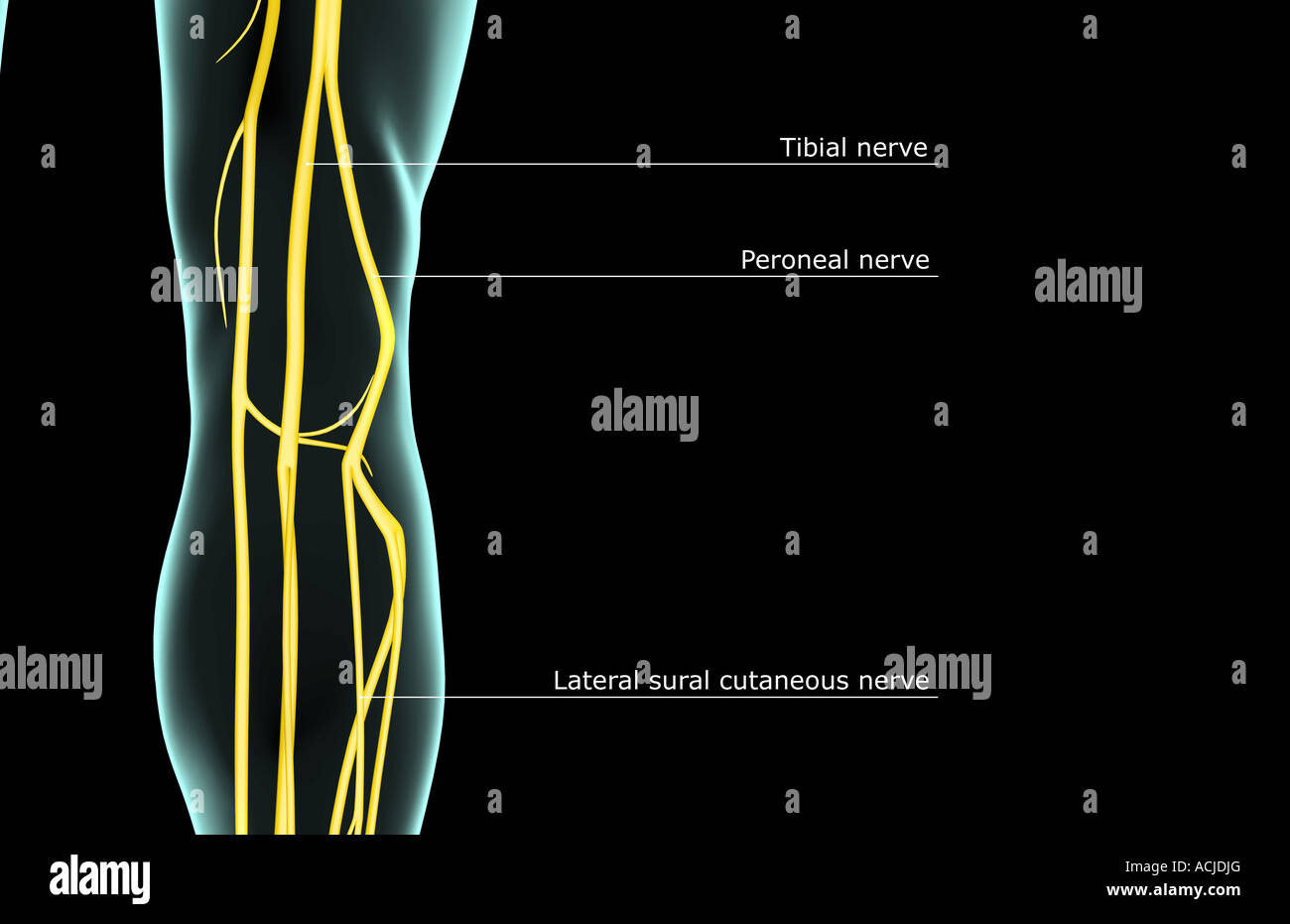 Prosthetic Knee Nerve Sensors Prosthetic Knee Nerve Sensors