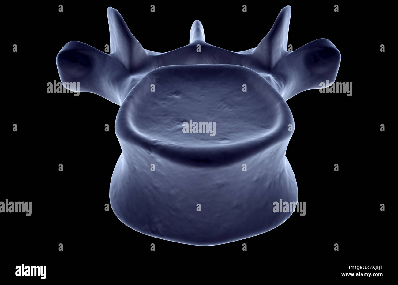 Lumbar vertebra hi-res stock photography and images - Alamy