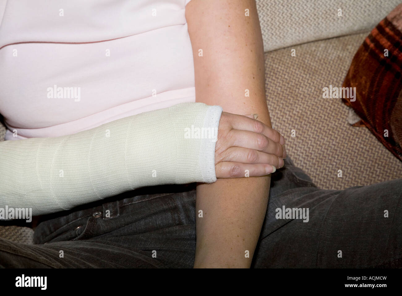 A FEMALE WITH A CAST ON HER BROKEN ARM Stock Photo - Alamy