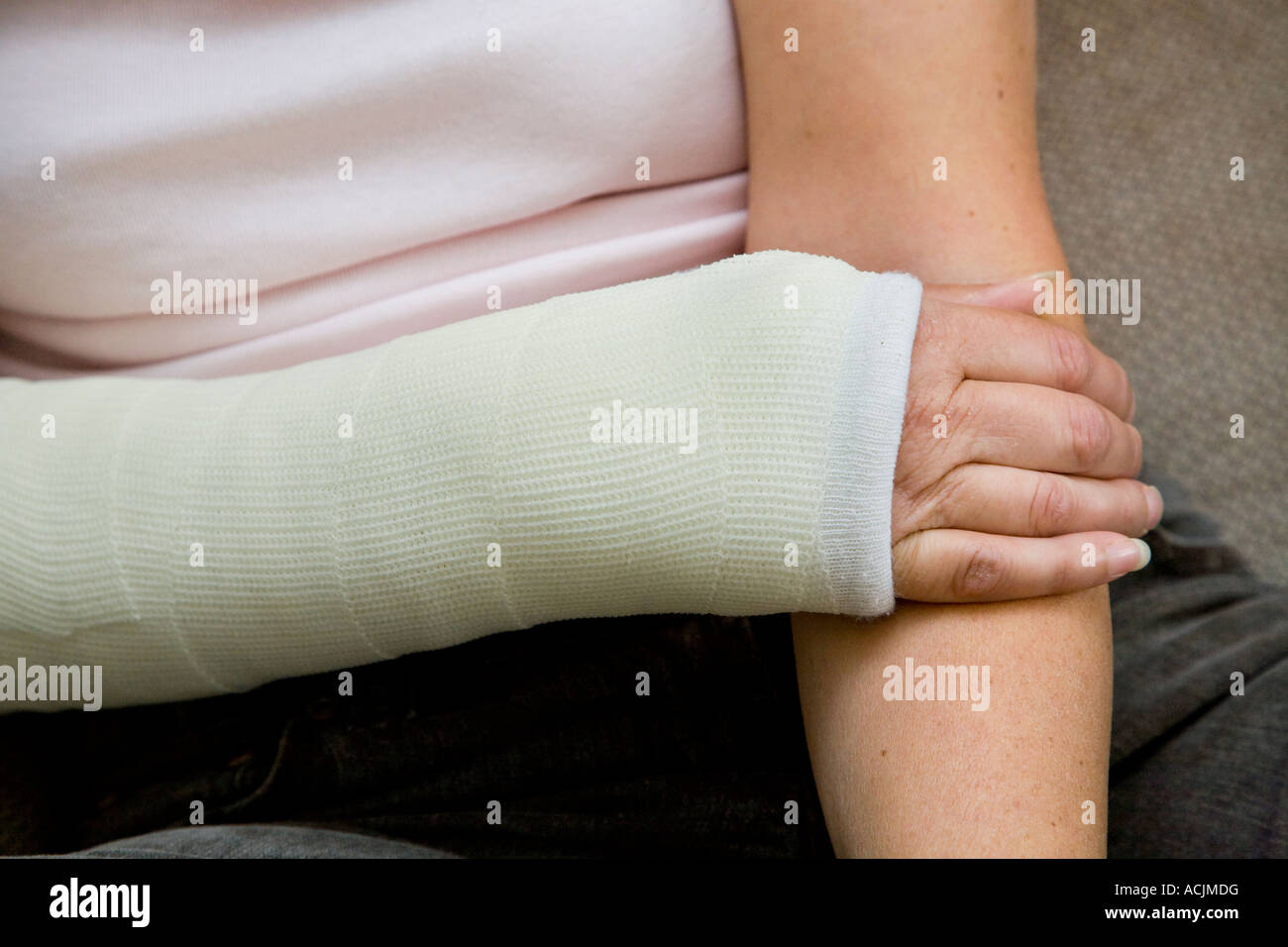 Plaster cast on arm hi-res stock photography and images - Alamy