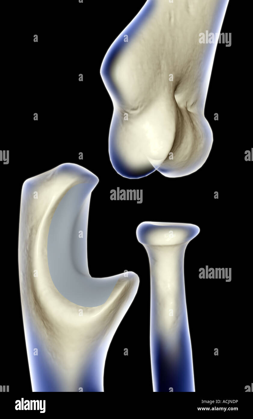 Medial epicondyle hi-res stock photography and images - Alamy