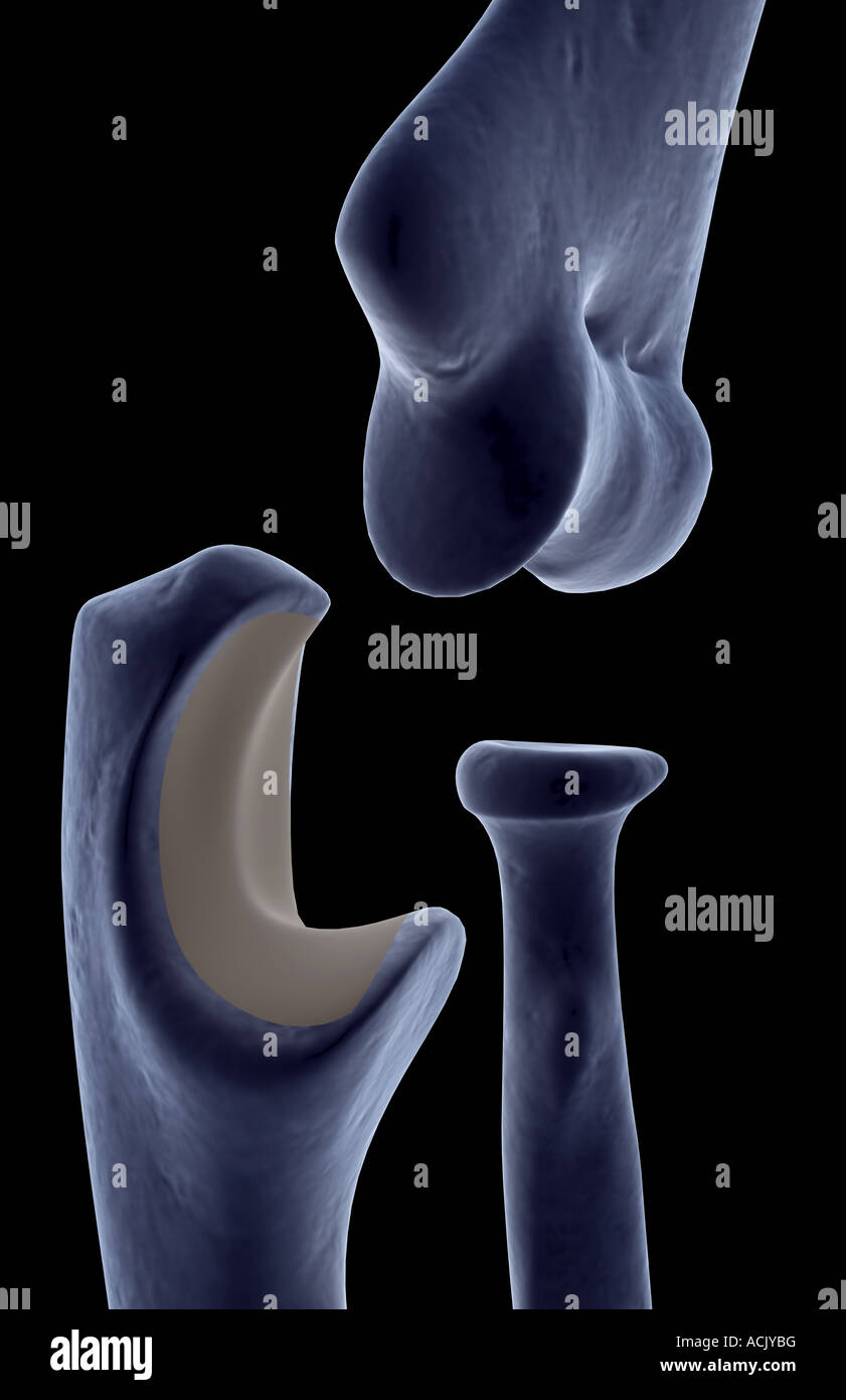Medial epicondyle hi-res stock photography and images - Alamy
