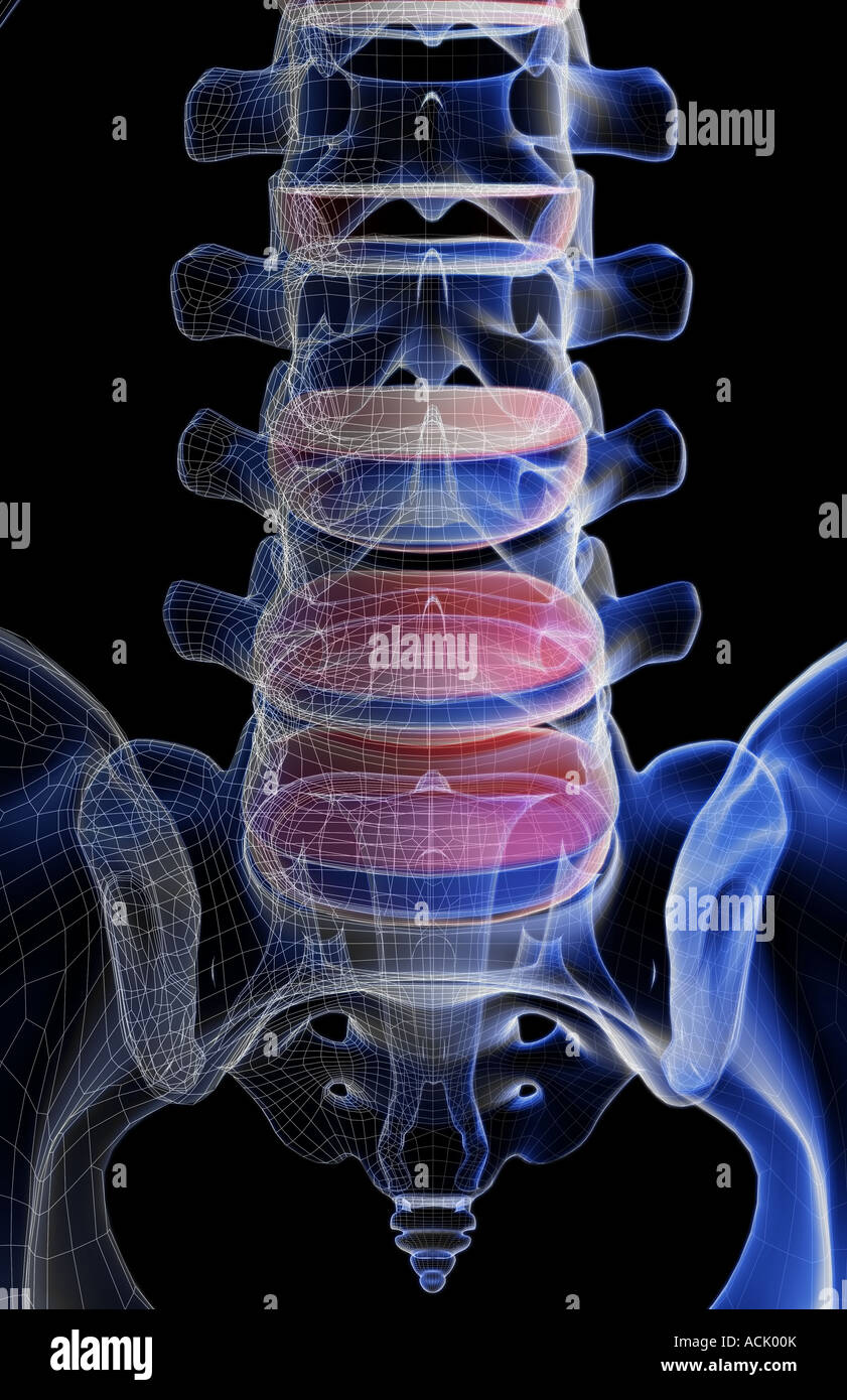 The bones of lumbar vertebrae Stock Photo - Alamy