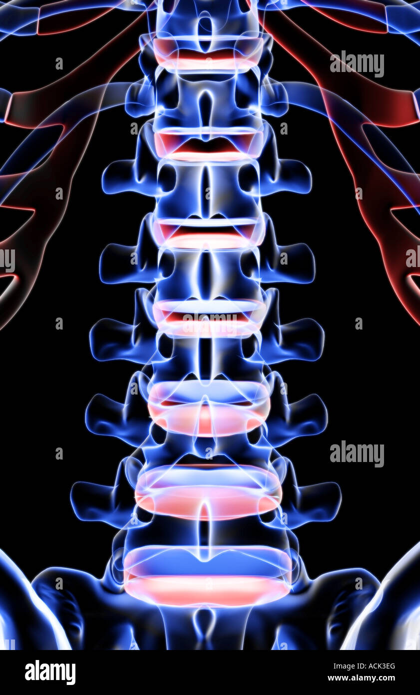 The bones of lumbar vertebrae Stock Photo - Alamy