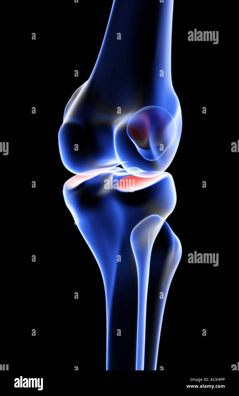 Medial Condyle Stock Photos & Medial Condyle Stock Images - Alamy