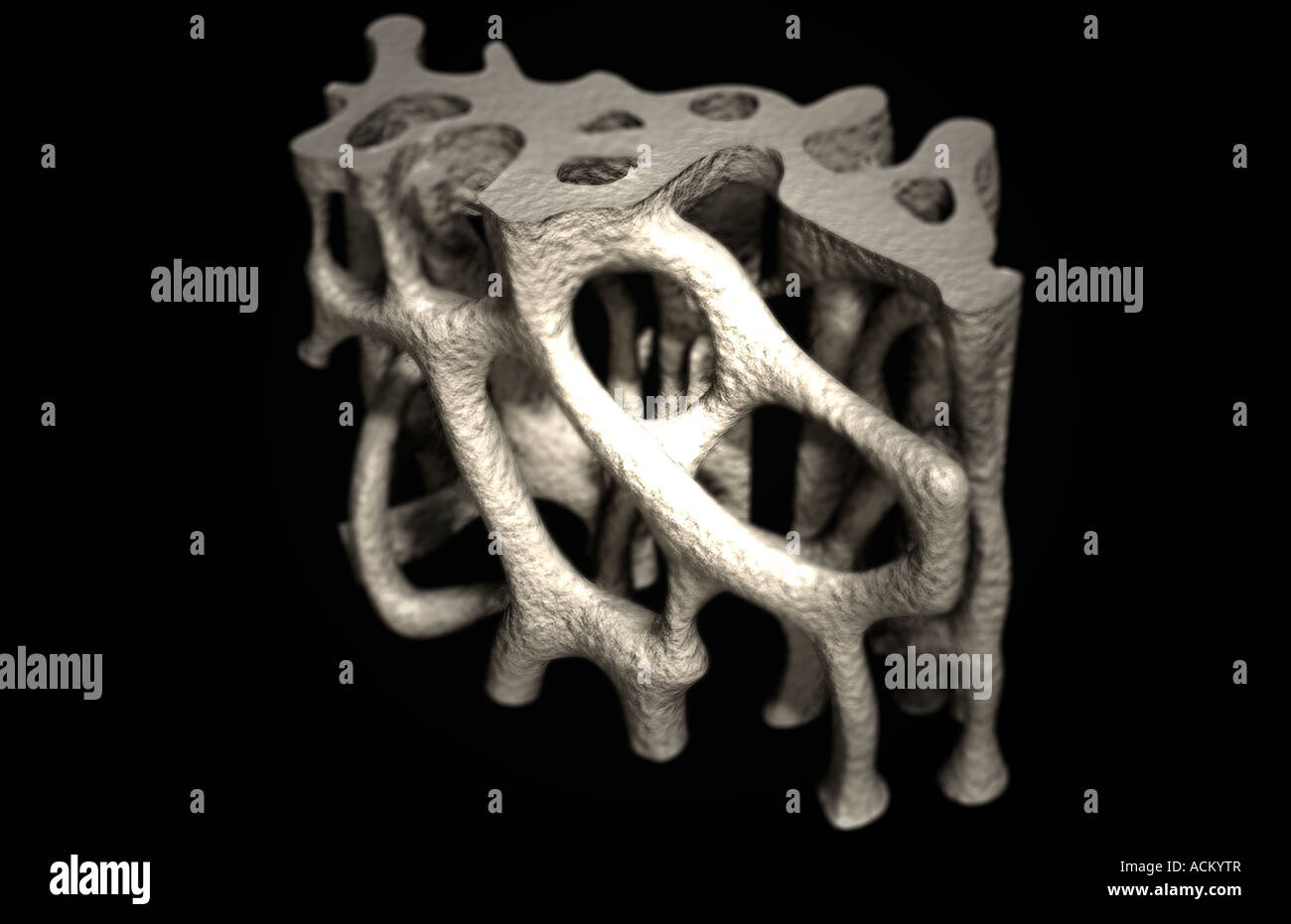 Osteoporosis bone structure Stock Photo - Alamy