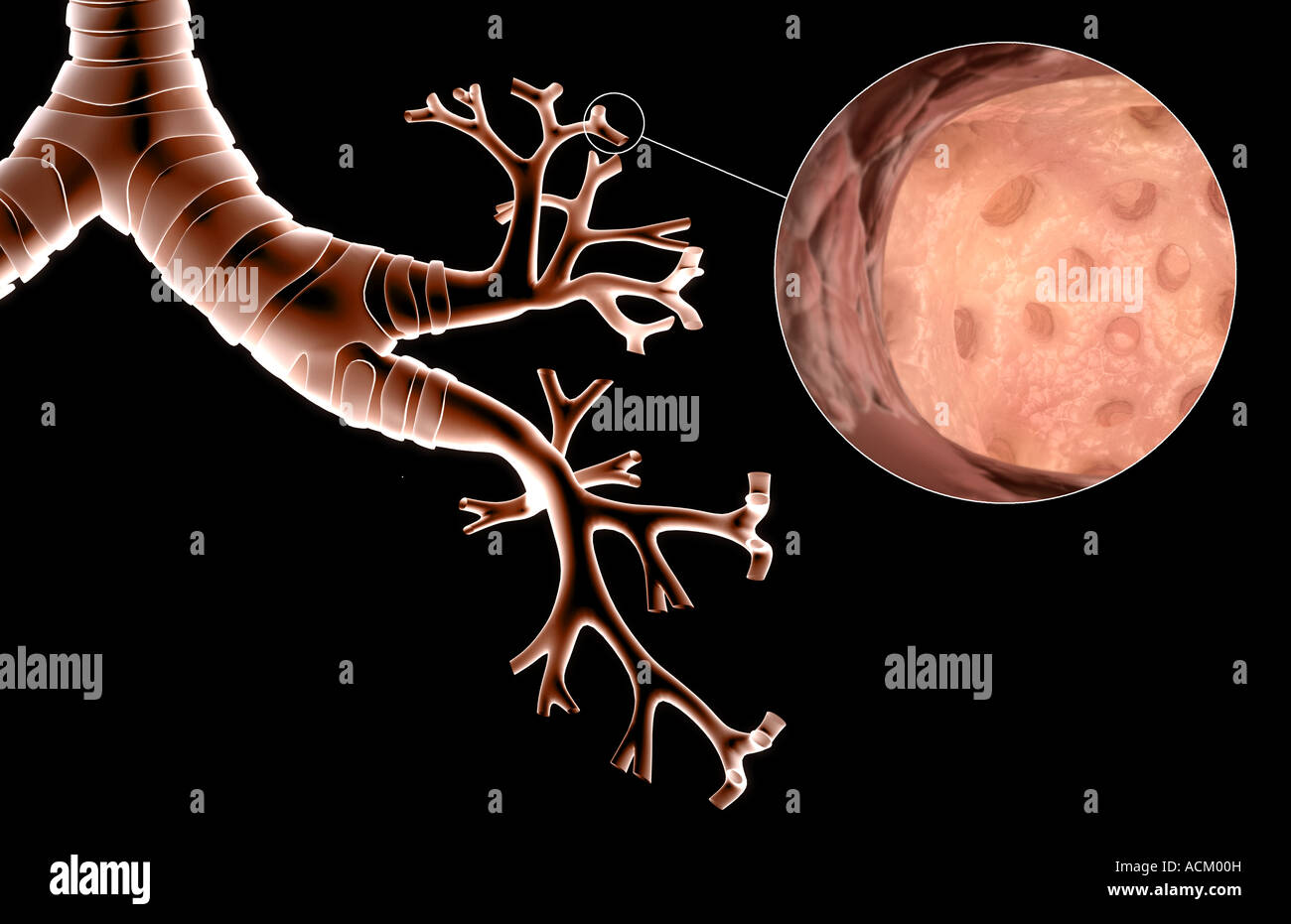 The bronchial tree and alveoli Stock Photo - Alamy