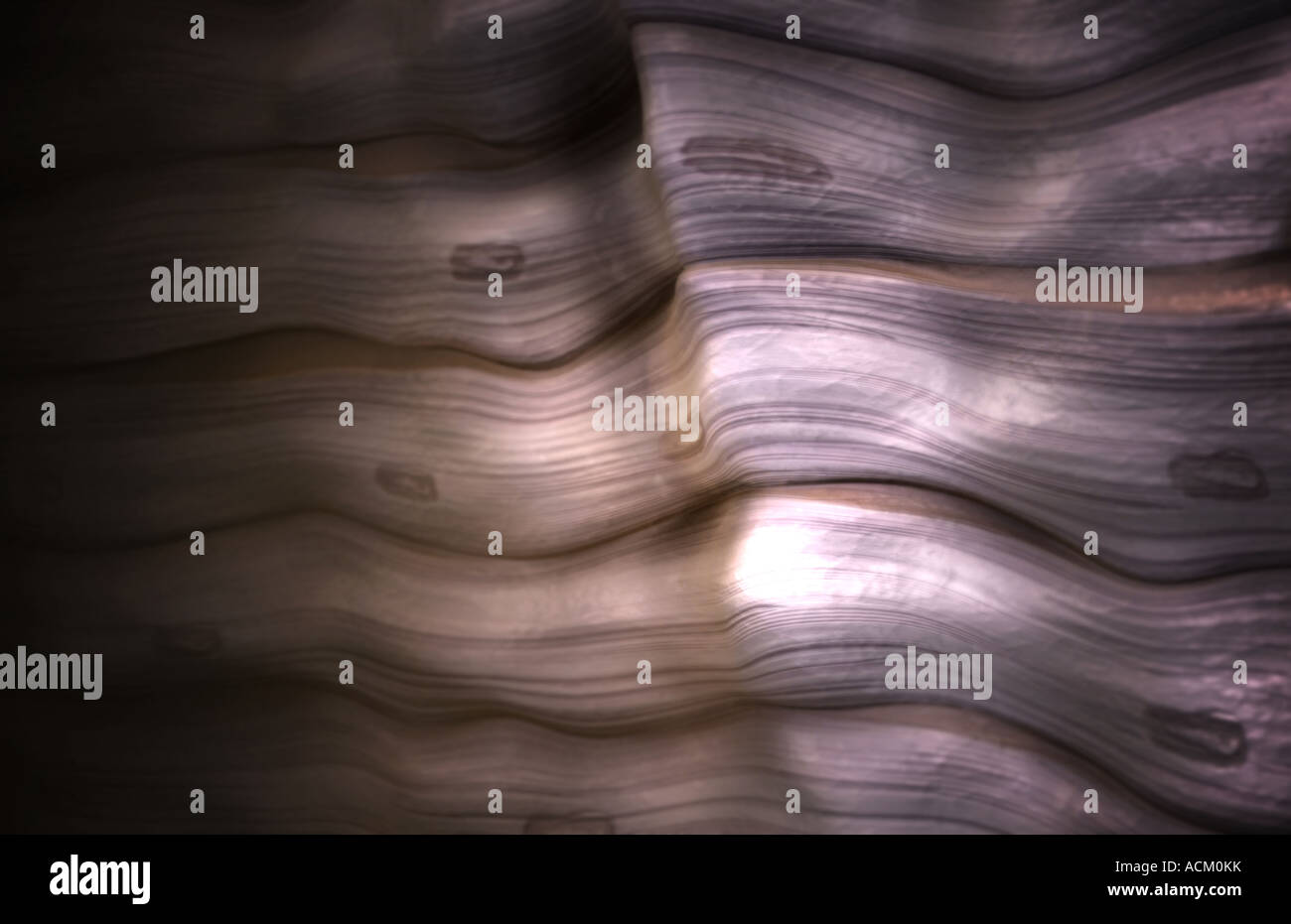 Dense fibrous connective tissue tendon hi-res stock photography and ...