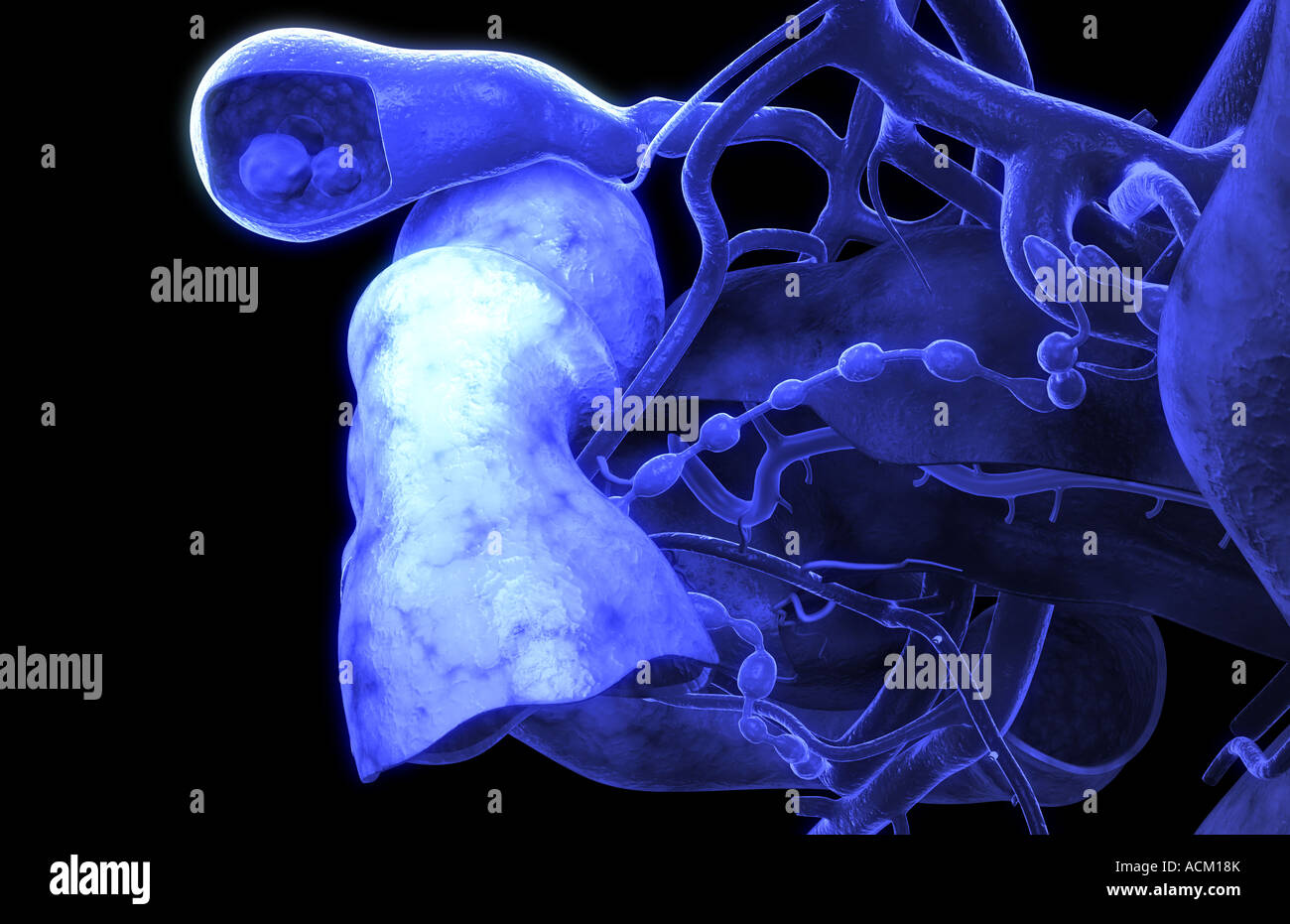 Cholesterol gallstones hi-res stock photography and images - Alamy