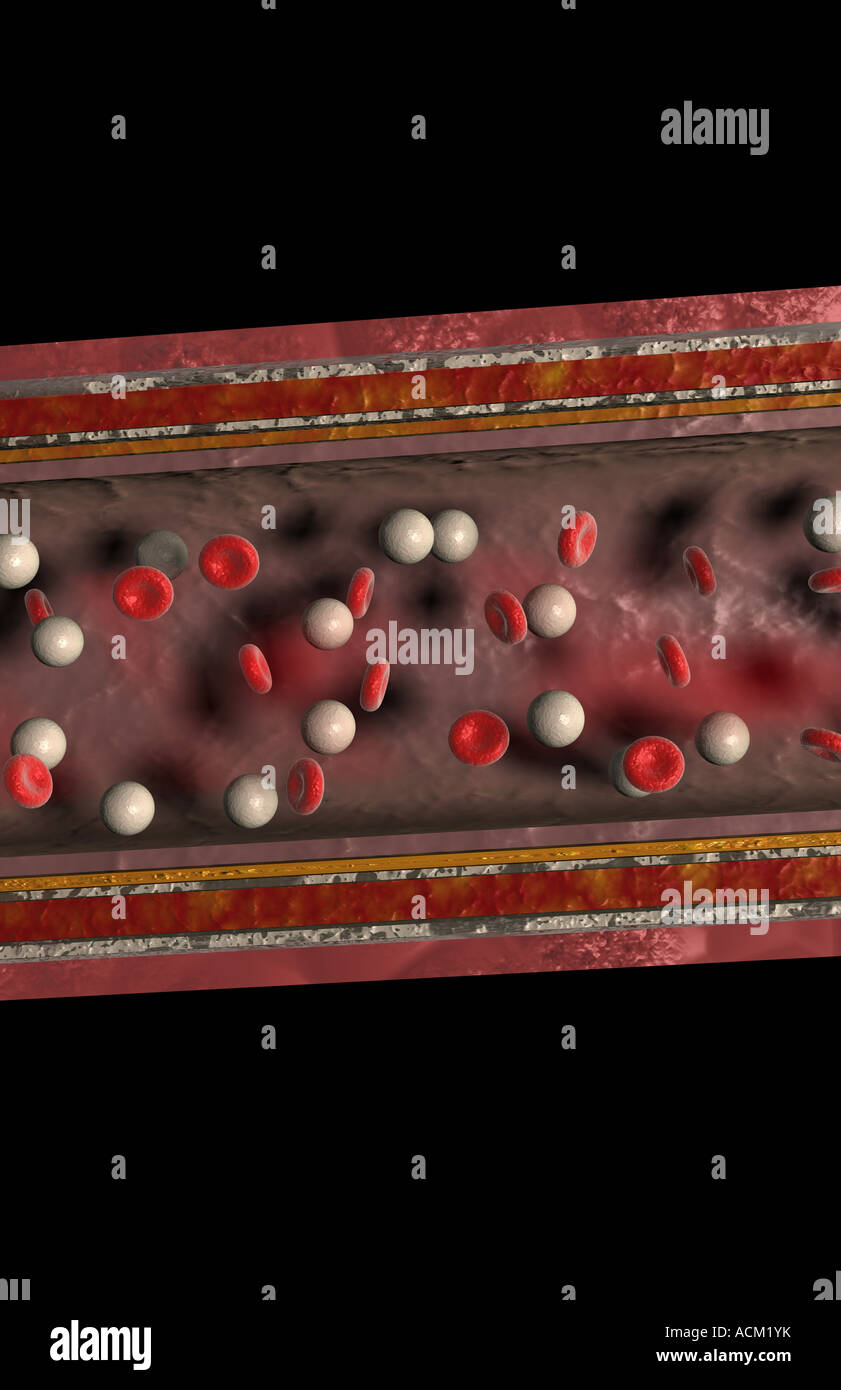 The arterial wall Stock Photo - Alamy