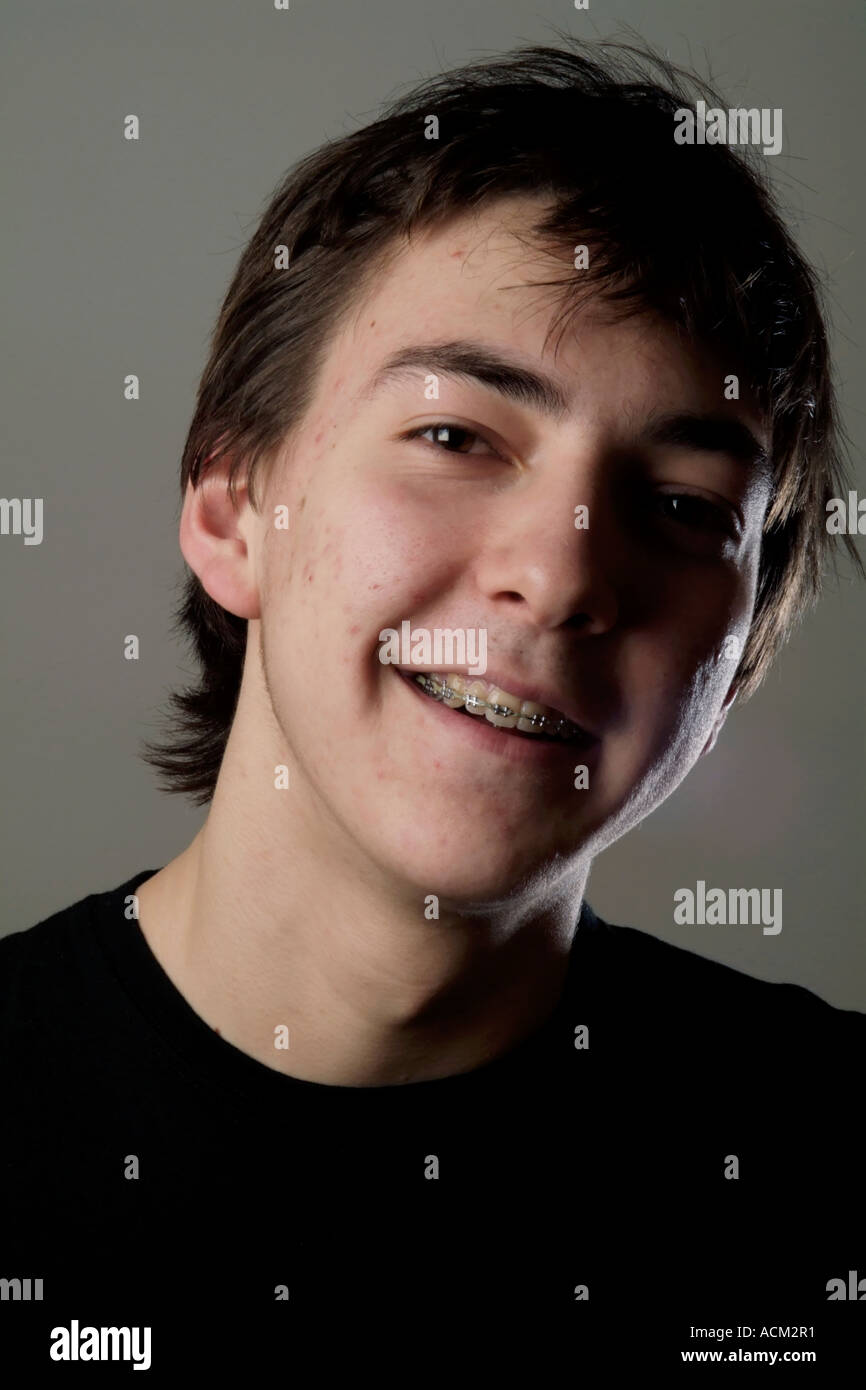 Retainers teen hi-res stock photography and images - Alamy