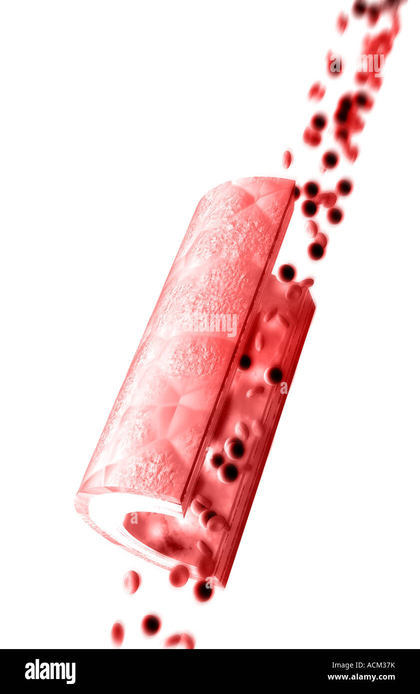 Blood flow hi-res stock photography and images - Alamy