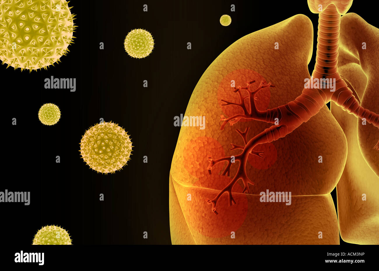 Asthma illustration hi-res stock photography and images - Alamy