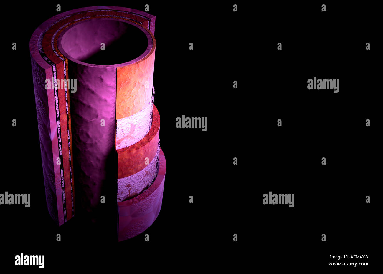 Media arterial hi-res stock photography and images - Alamy