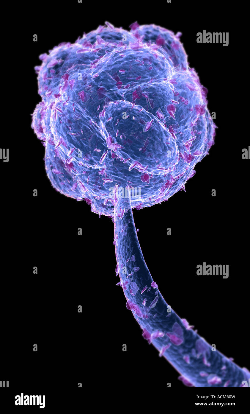 Stachybotrys chartarum hi-res stock photography and images - Alamy