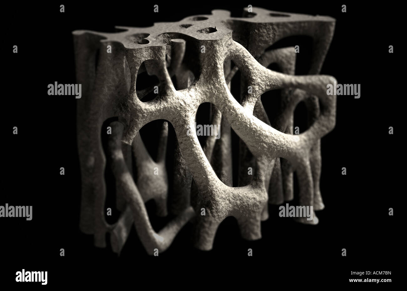 Bone structure osteoporosis hi-res stock photography and images - Alamy