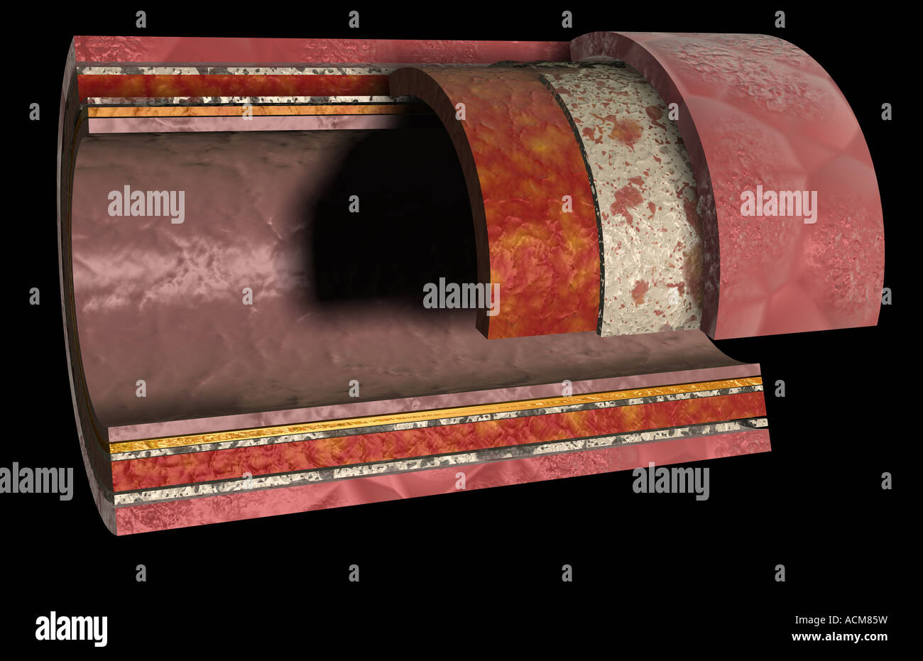 Media arterial hi-res stock photography and images - Alamy