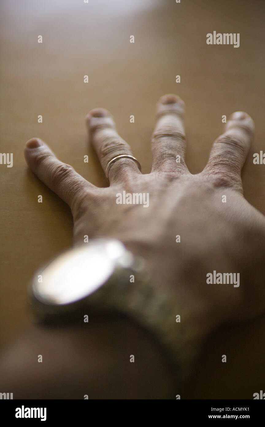 Wedding band on Man s Hand Stock Photo - Alamy