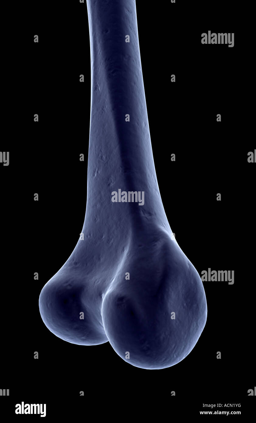Sulcus Terminalis Femur