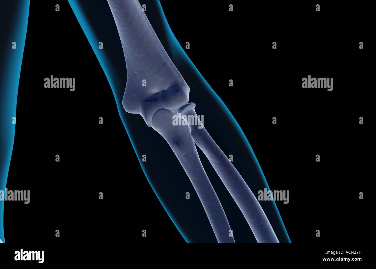 The bones of the elbow Stock Photo - Alamy