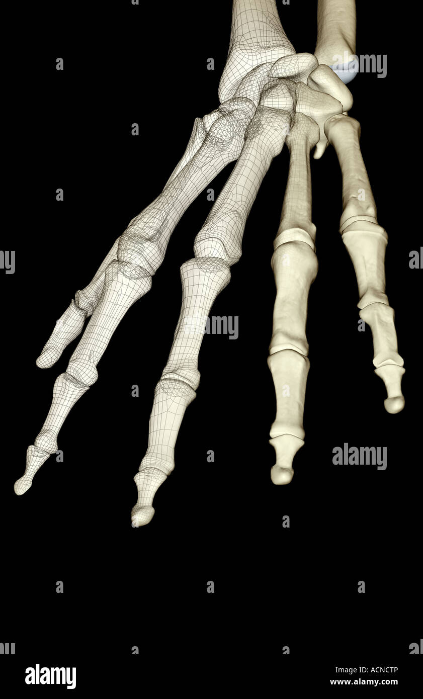 Bones Hand Phalanx Phalanges Stock Photos & Bones Hand Phalanx ...
