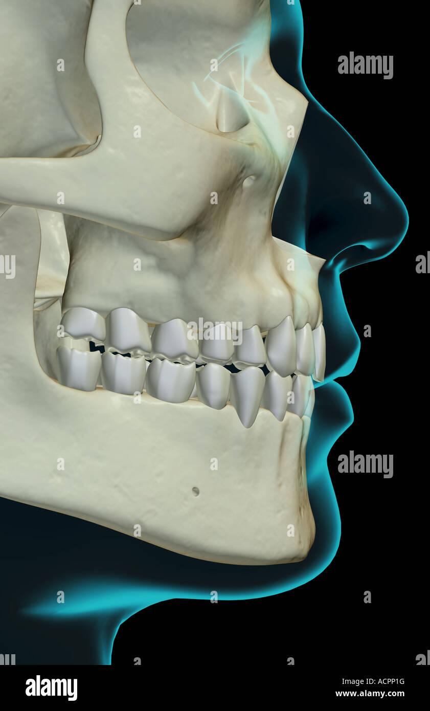 The bones of the jaw Stock Photo - Alamy