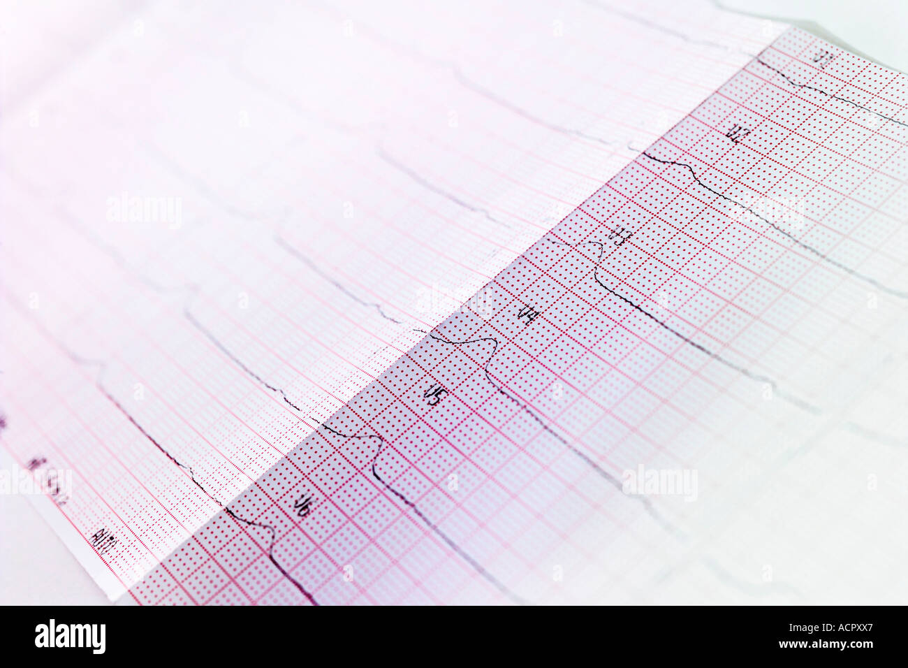 Ecg print out hi-res stock photography and images - Alamy
