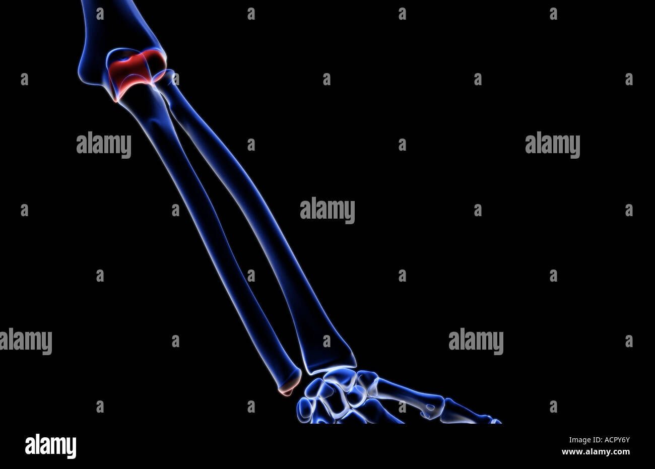 Forearm bones hi-res stock photography and images - Alamy